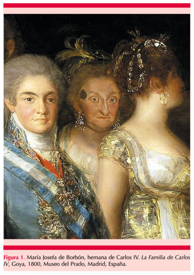 La familia de Carlos IV (segunda parte) – Dermatología Revista mexicana